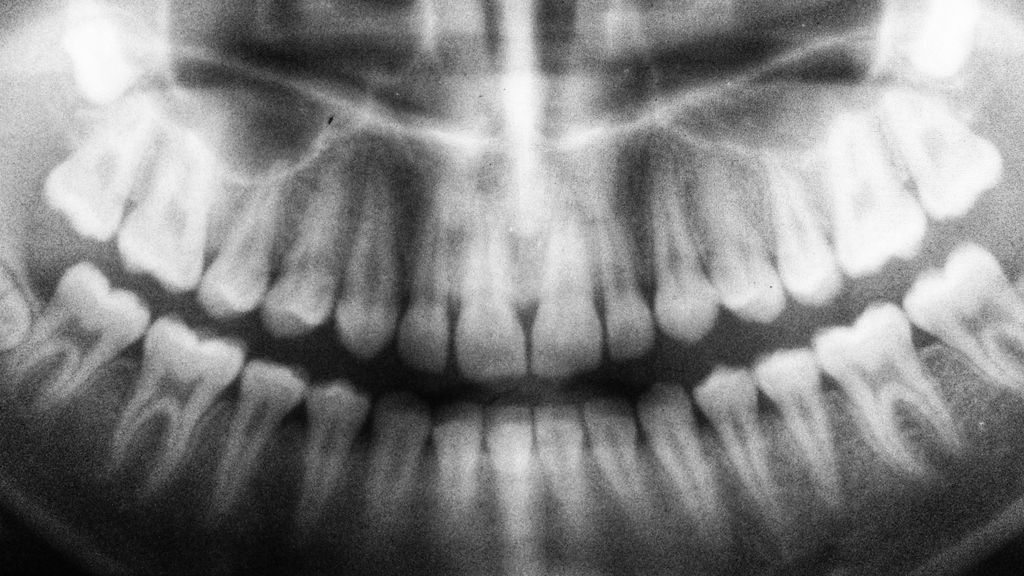 Dentes são ossos? Entenda do que são feitos e como nascem - Canaltech