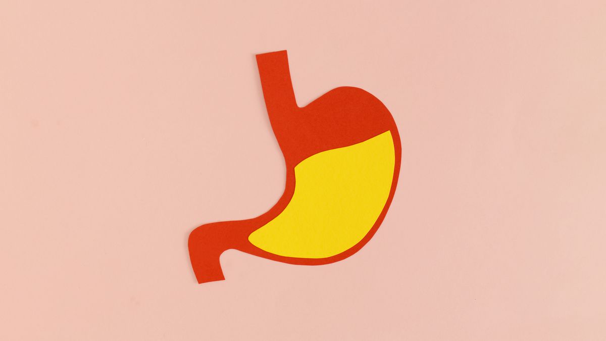 Como funciona o balão gástrico engolível que acaba de chegar ao Brasil ...