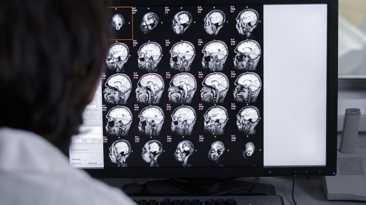 Brasileiros clonam tumor para combater câncer cerebral - Canaltech